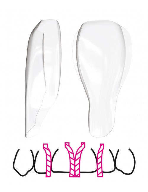Bioclear Anterior